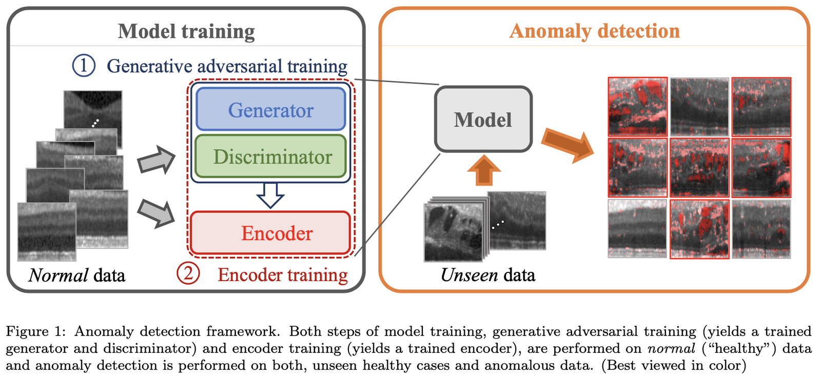 F Anogan Fast Unsupervised Anomaly Detection With Generative Adversarial Networks Mulkong